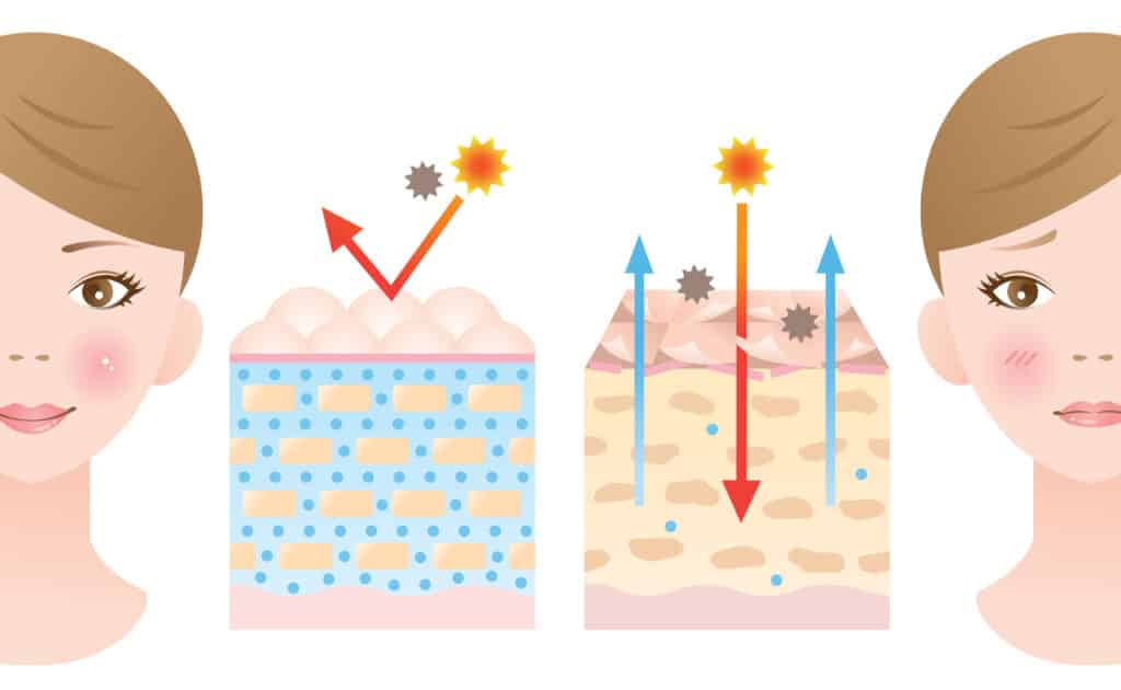 Damaged Skin Barrier: What It Is & How to Repair It